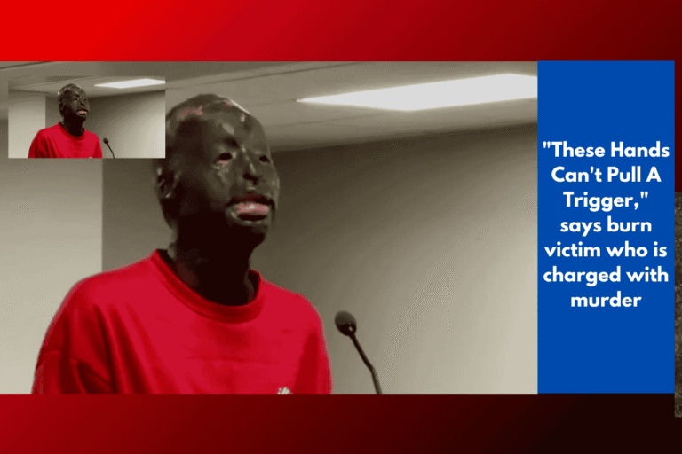 "These Hands Can't Pull A Trigger," says burn victim who is charged ...